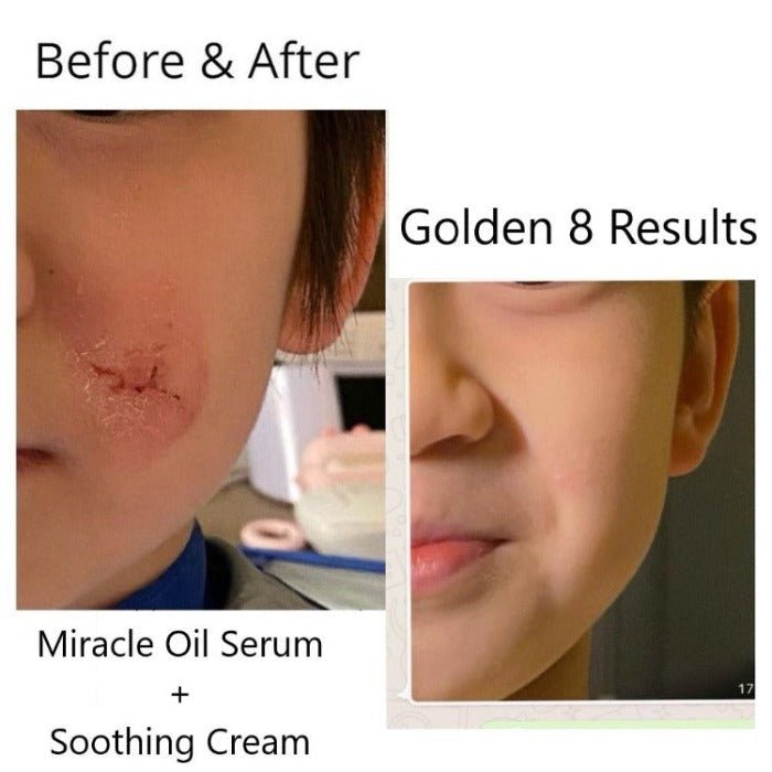 Soothe & Renew Duo: Miracle Oil Serum + Soothing Cream | Golden 8 ...